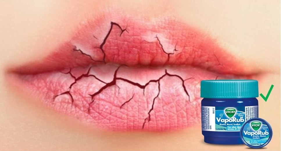 Conozca 8 usos alternativos del vaporub - Beliefnet